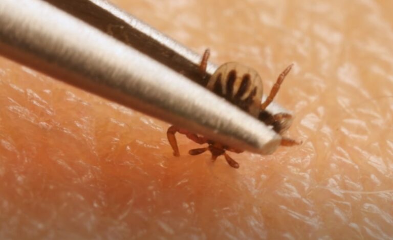 What To Do If Your Child Gets a Tick Bite: A Parent's Quick Guide